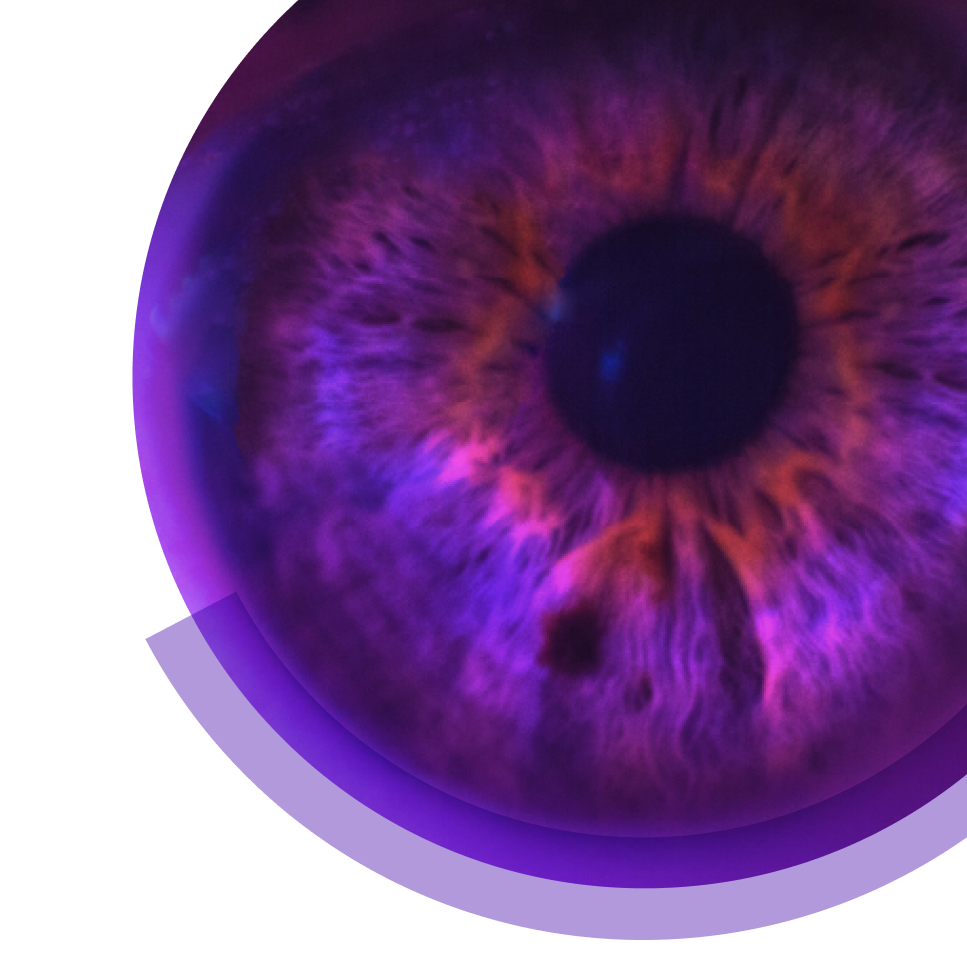 Overcoming Challenges in Implementing Data Mesh